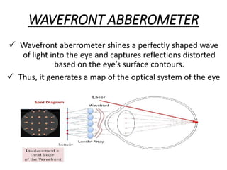 Abberations of refractive error | PPTX
