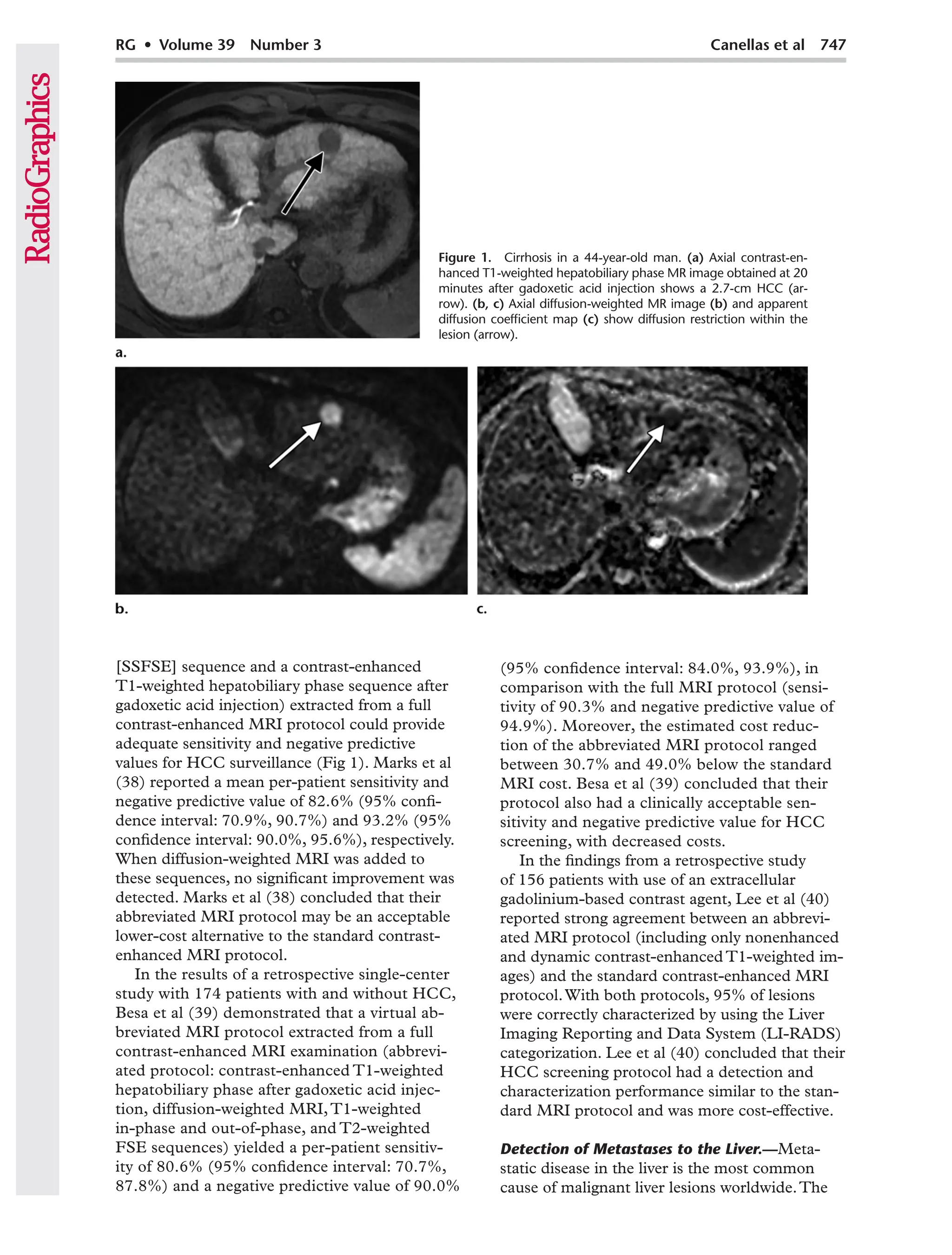 Abbreviated MRI Protocols for the Abdomen _ RadioGraphics.mhtml.pdf