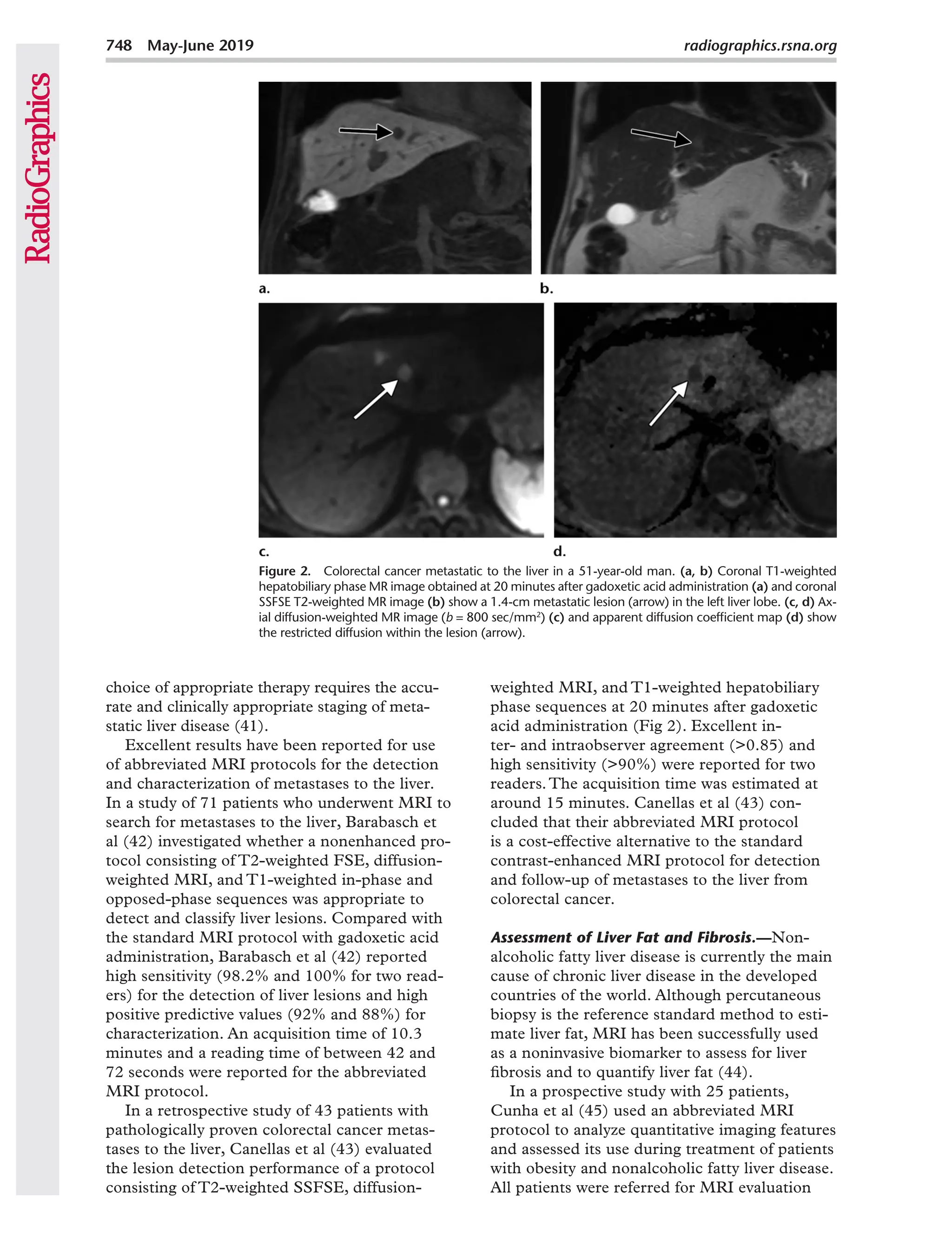 Abbreviated MRI Protocols for the Abdomen _ RadioGraphics.mhtml.pdf