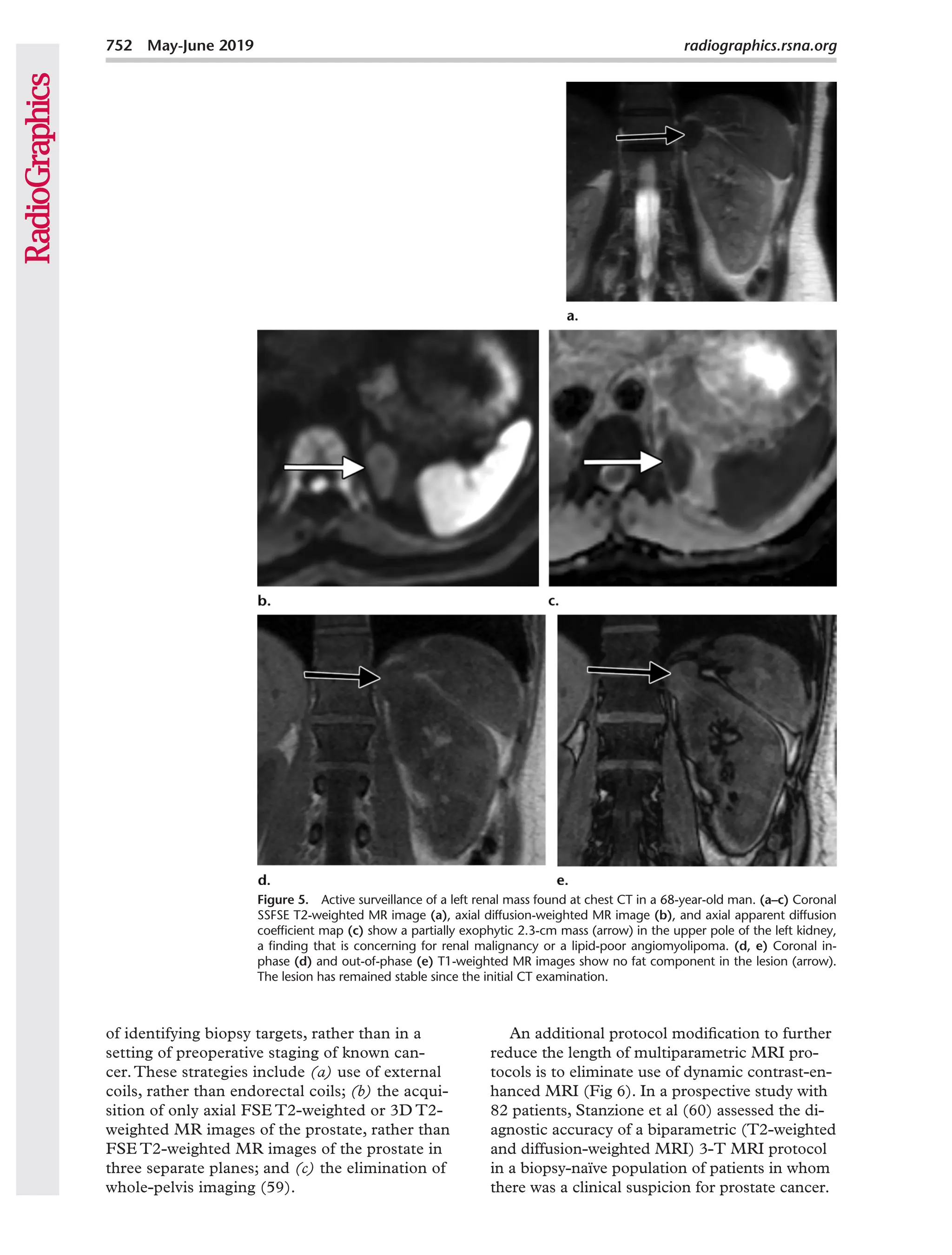 Abbreviated MRI Protocols for the Abdomen _ RadioGraphics.mhtml.pdf