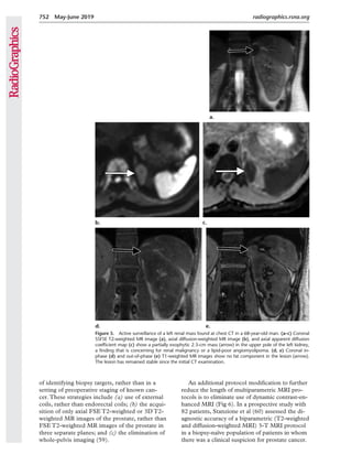 Abbreviated MRI Protocols for the Abdomen _ RadioGraphics.mhtml.pdf