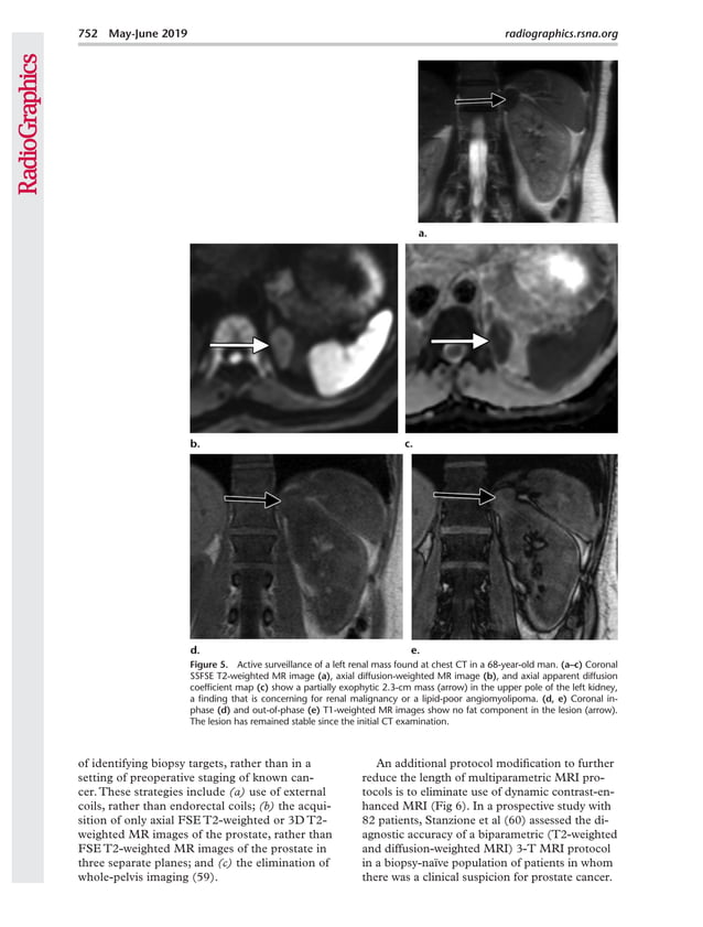 Abbreviated MRI Protocols for the Abdomen _ RadioGraphics.mhtml.pdf