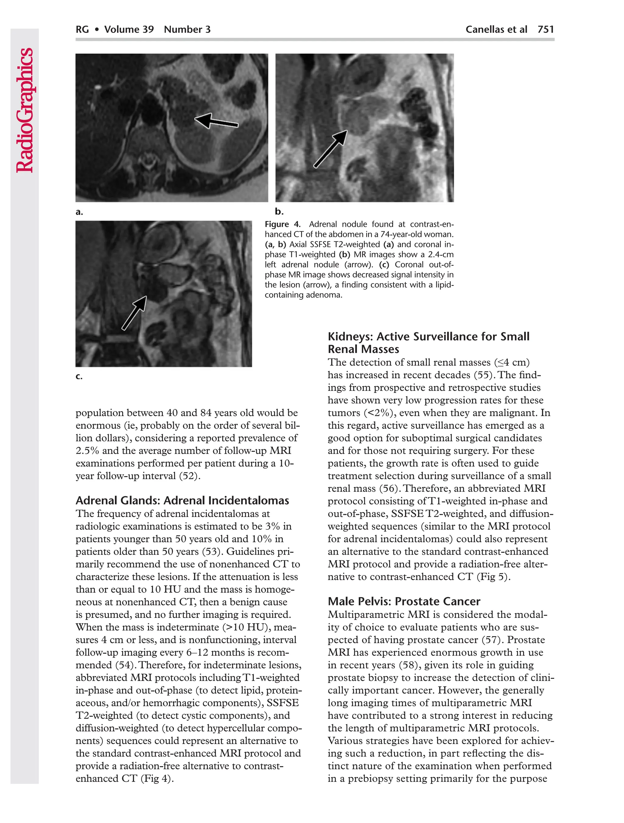 Abbreviated MRI Protocols for the Abdomen _ RadioGraphics.mhtml.pdf