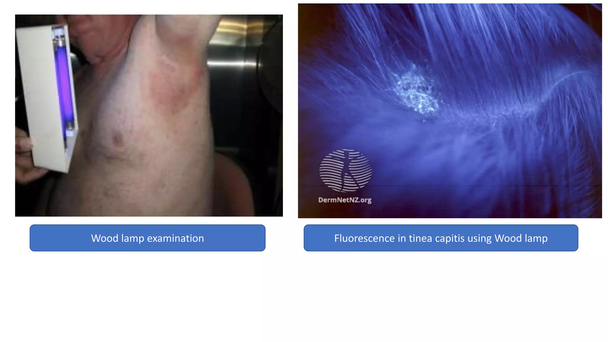 laboratory diagnosis of fungal inections | PPTX