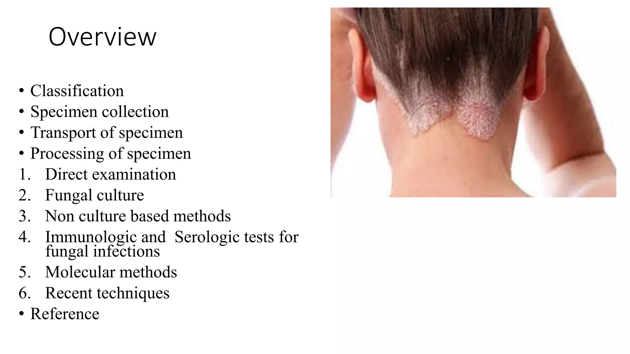 laboratory diagnosis of fungal inections | PPTX