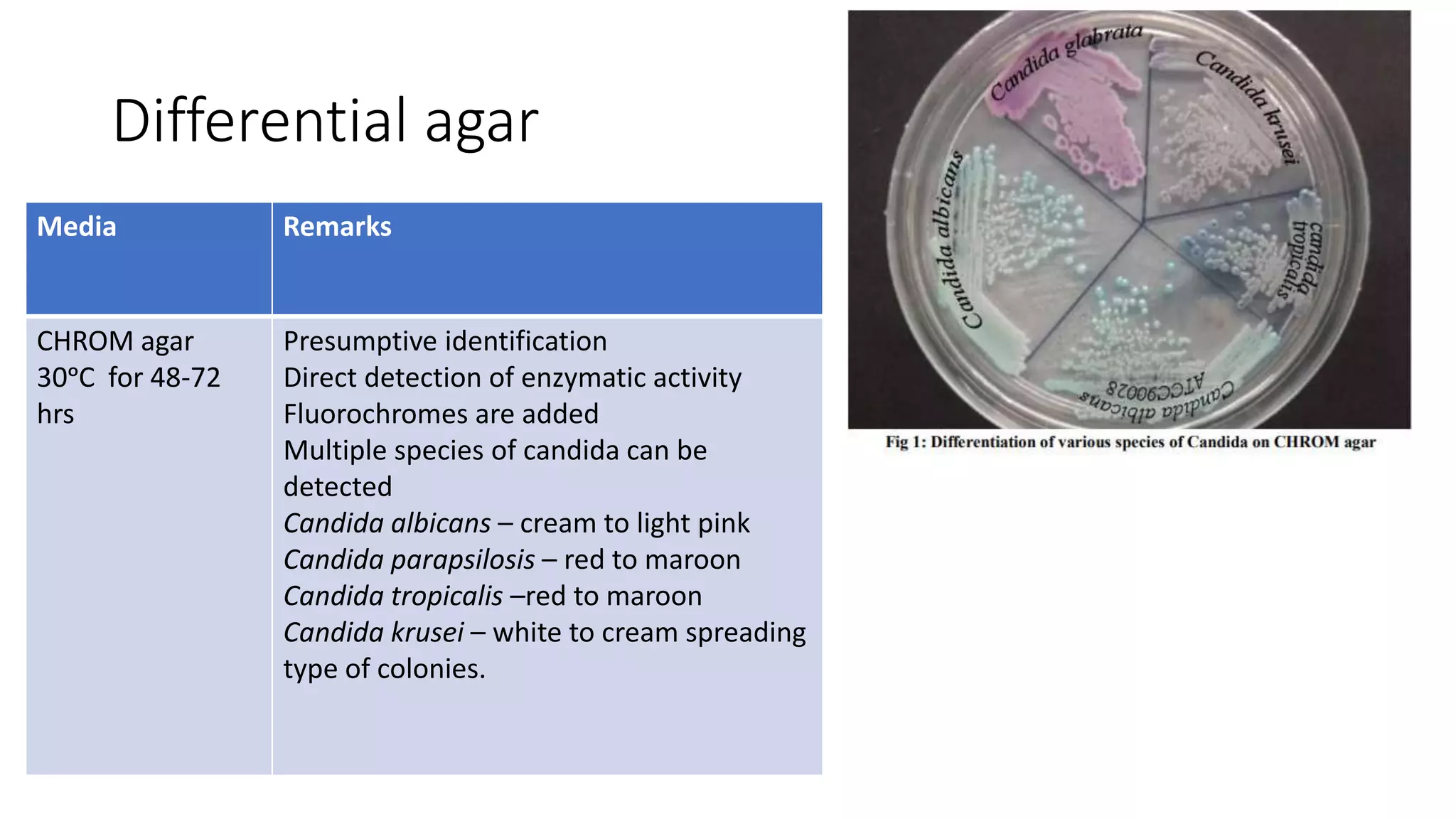 laboratory diagnosis of fungal inections | PPTX