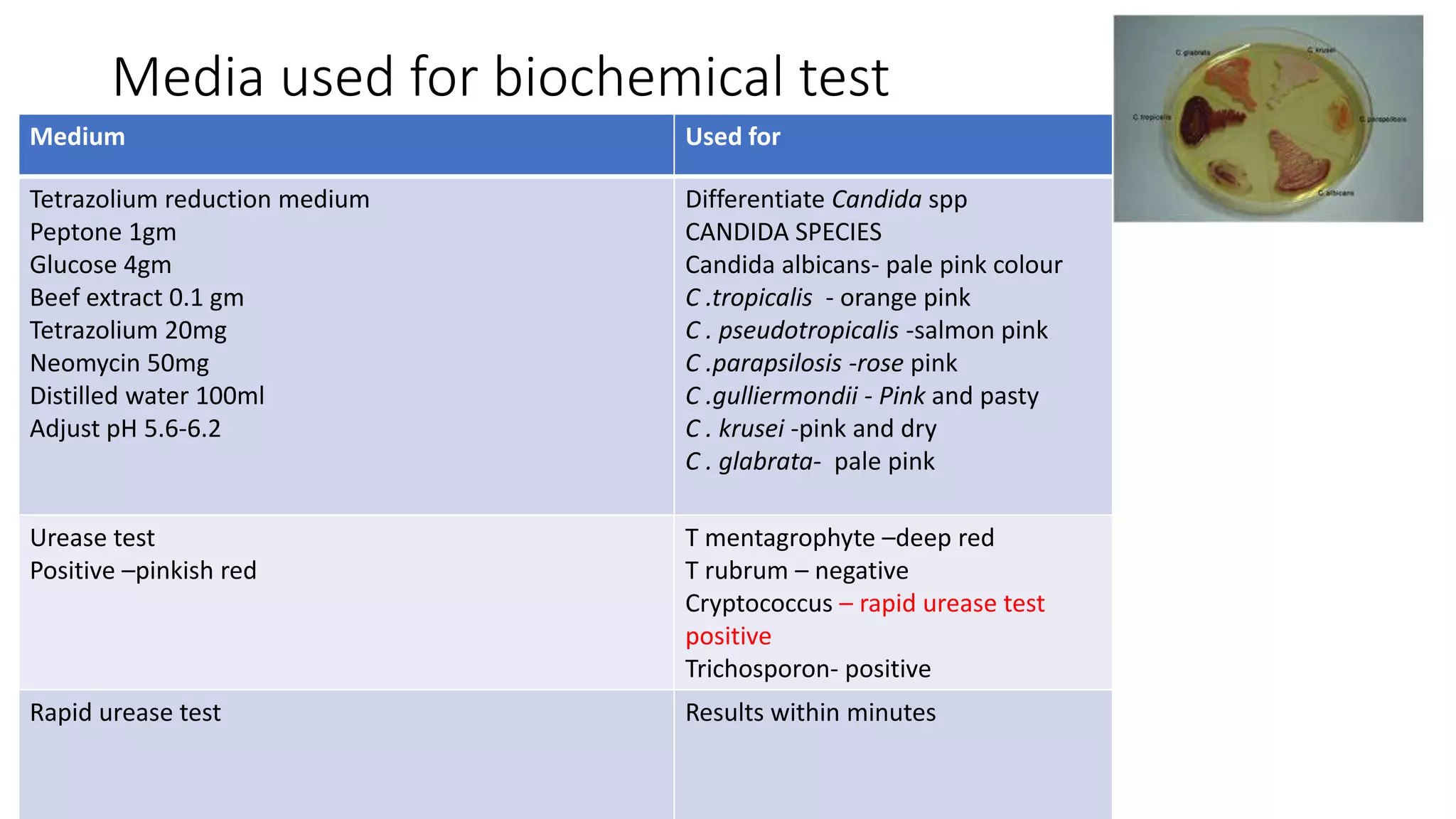laboratory diagnosis of fungal inections | PPTX