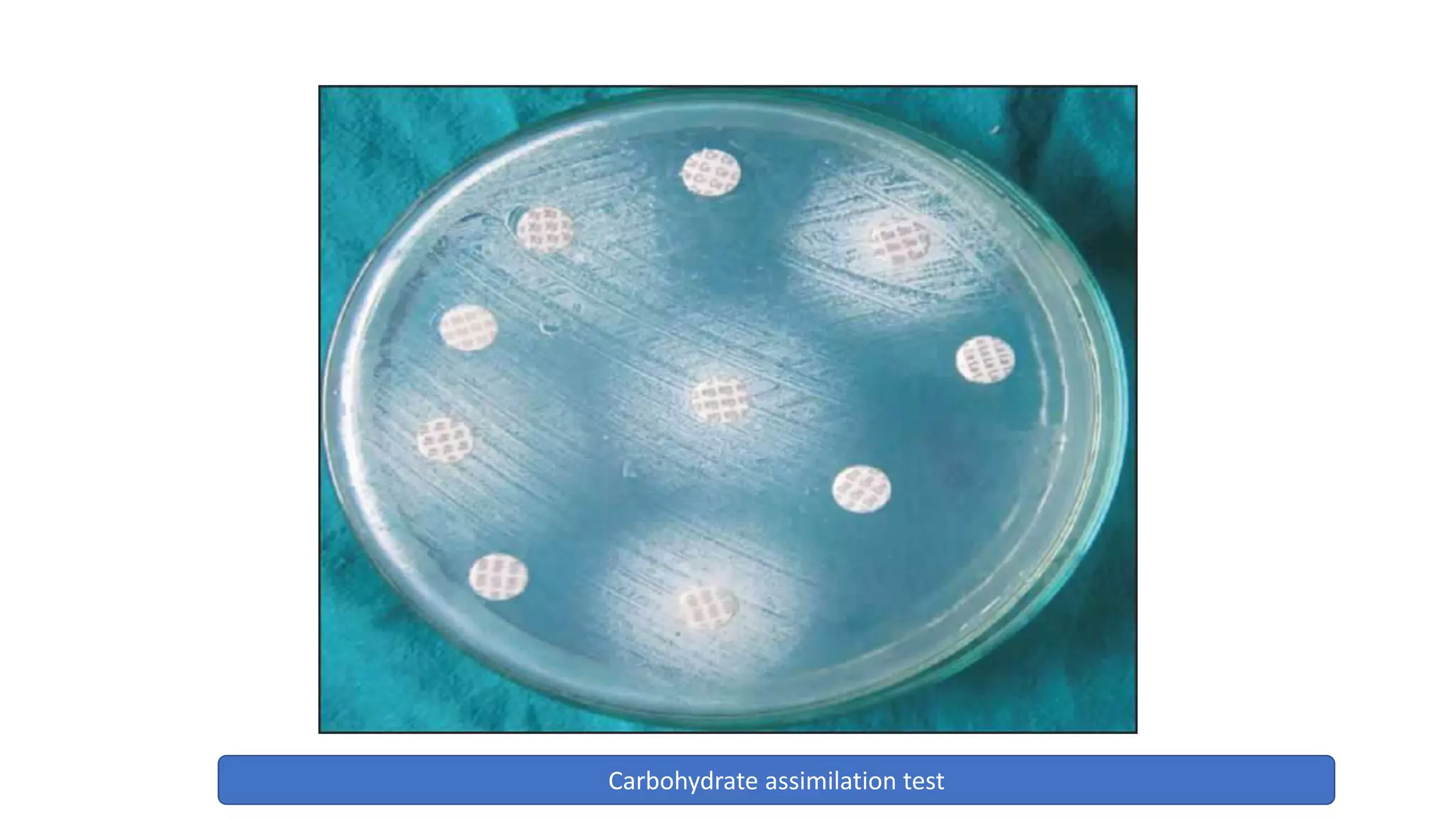 laboratory diagnosis of fungal inections | PPTX