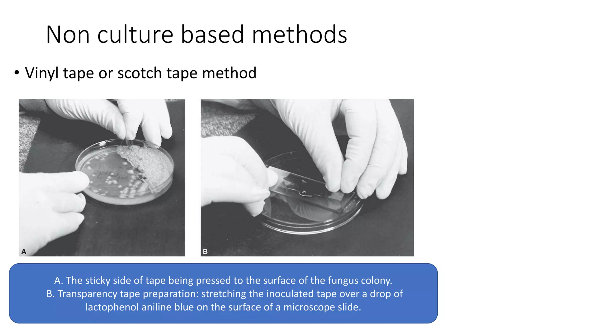 laboratory diagnosis of fungal inections | PPTX