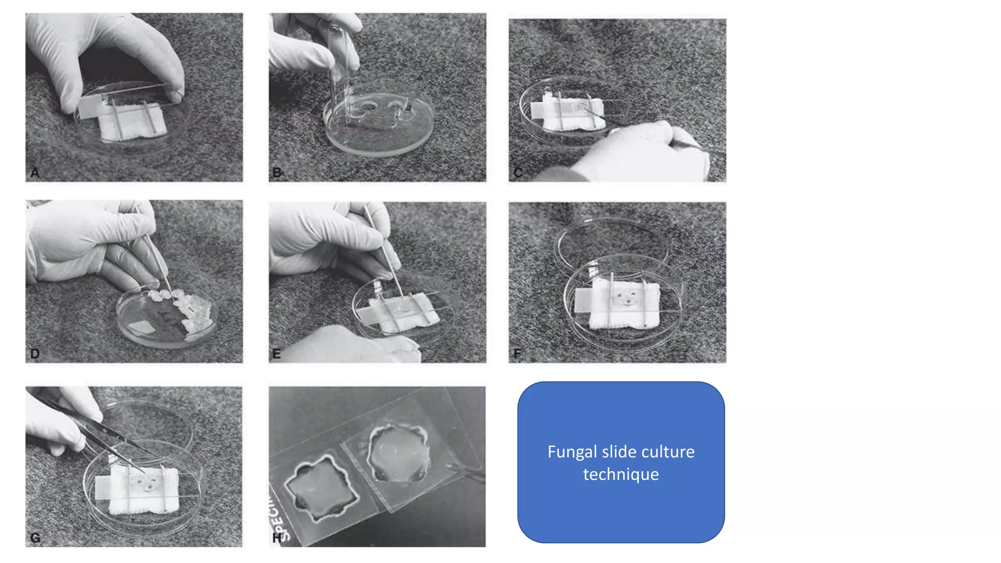 laboratory diagnosis of fungal inections | PPTX