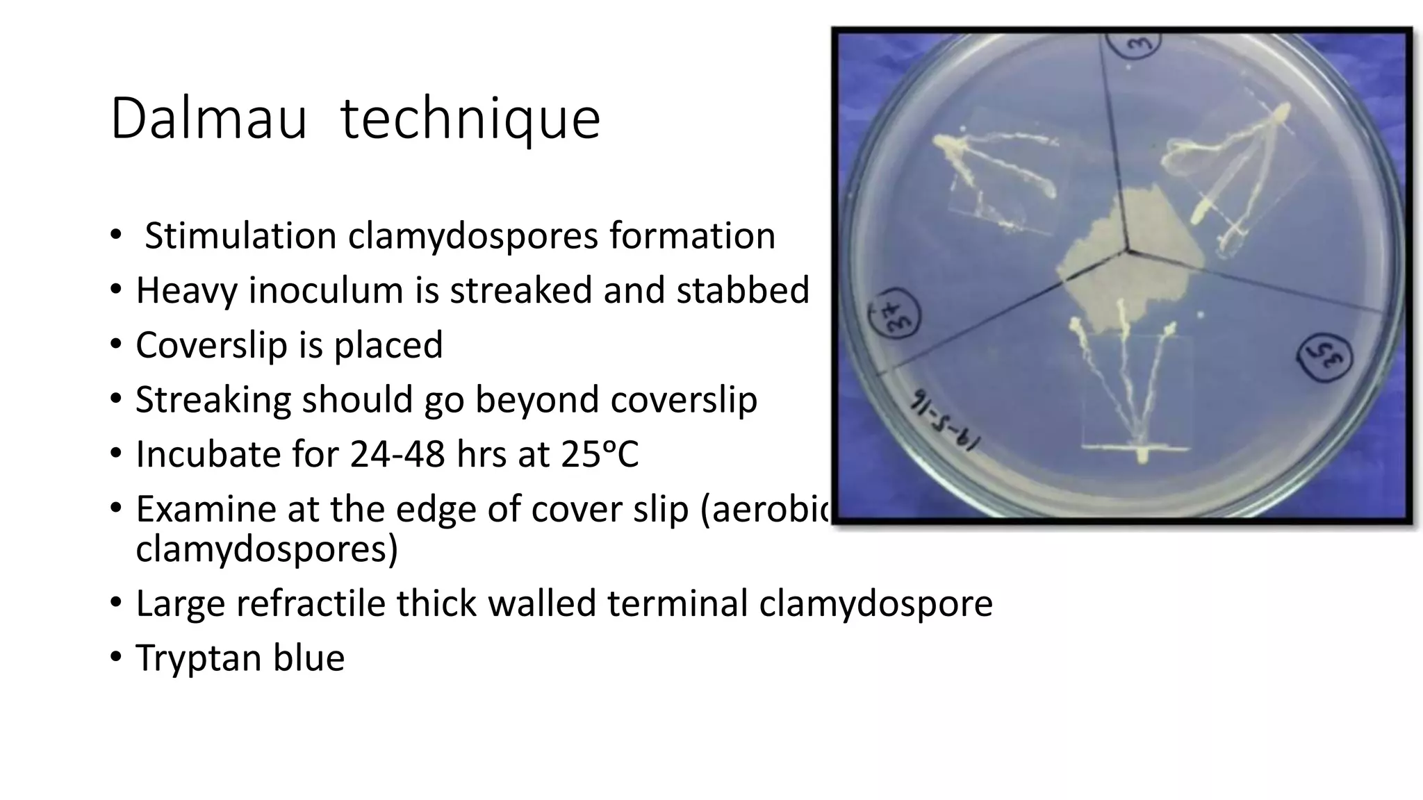 laboratory diagnosis of fungal inections | PPTX