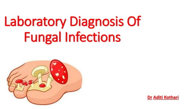 laboratory diagnosis of fungal inections | PPTX