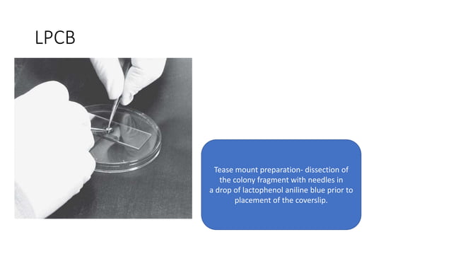 laboratory diagnosis of fungal inections | PPTX