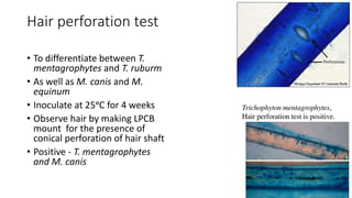 laboratory diagnosis of fungal inections | PPTX