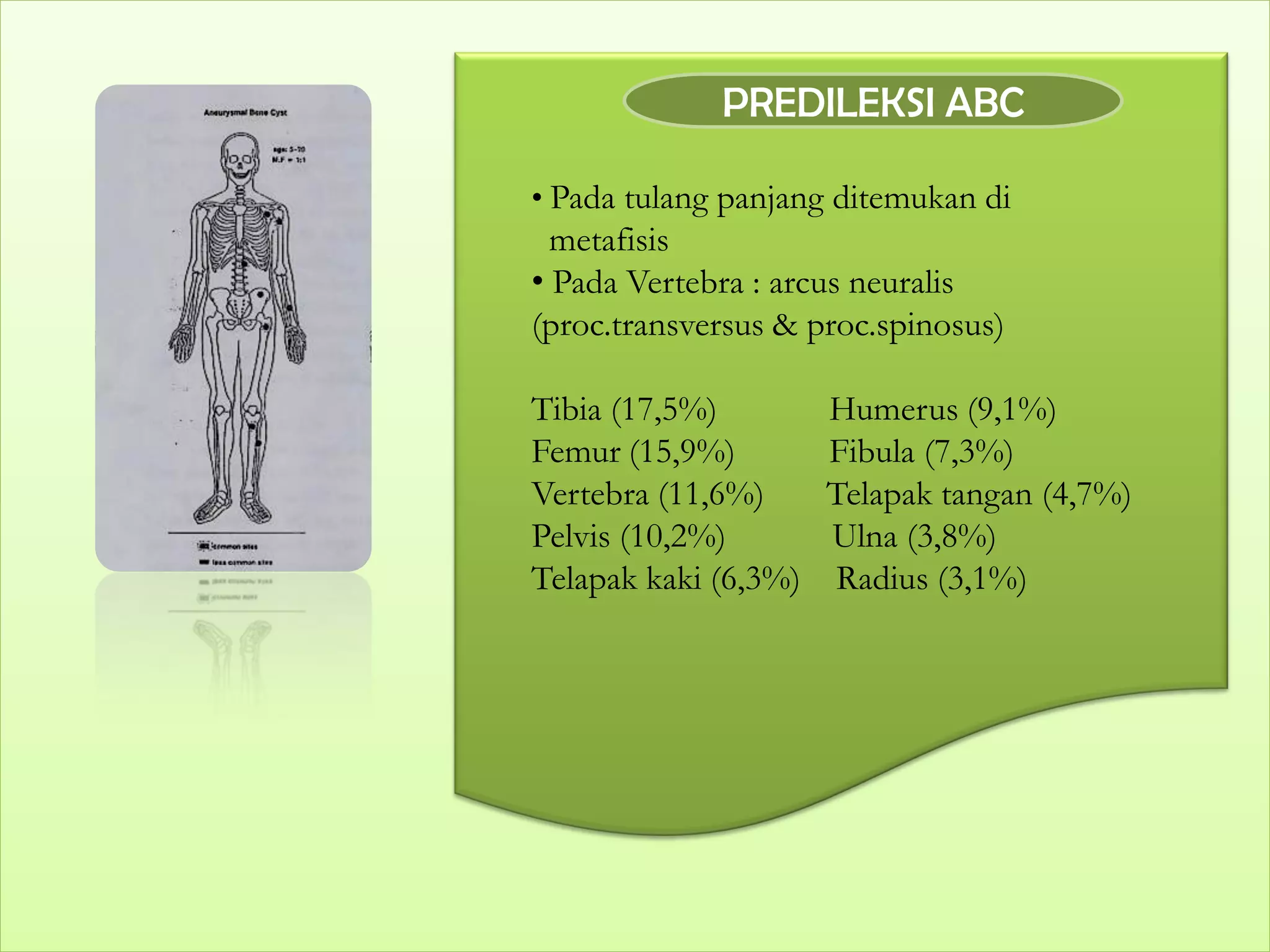 ABC (Aneurysmal Bone Cyst) - Rahmayanti Arief (PP).pdf