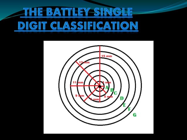 Fingerprint Classification | PPTX