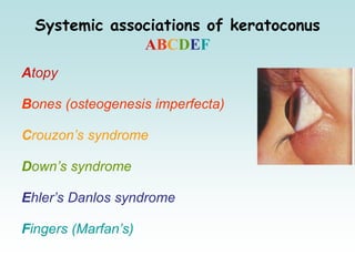 A, B, C, D, .... | PPT | Eye and Vision Conditions | Diseases and ...