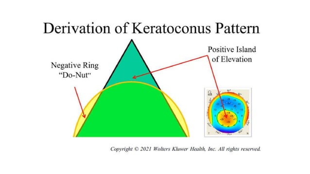 Keratoconus: ABCD classification | PPT