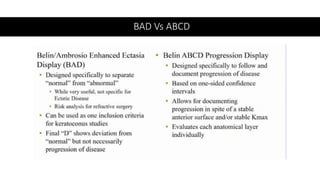Keratoconus: ABCD classification | PPT