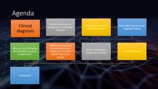 Keratoconus: ABCD classification | PPT