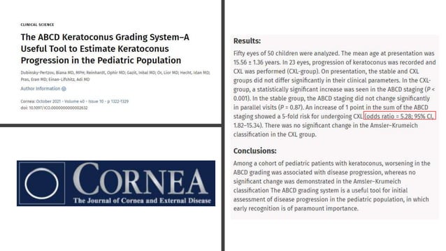 Keratoconus: ABCD classification | PPT