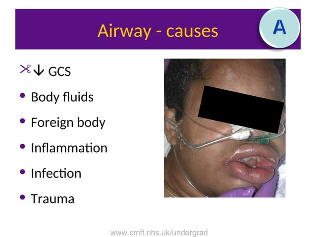 ABCDE ATLS guidelines and management of trauma.ppt | First Aid | Injuries