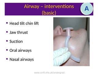 ABCDE ATLS guidelines and management of trauma.ppt