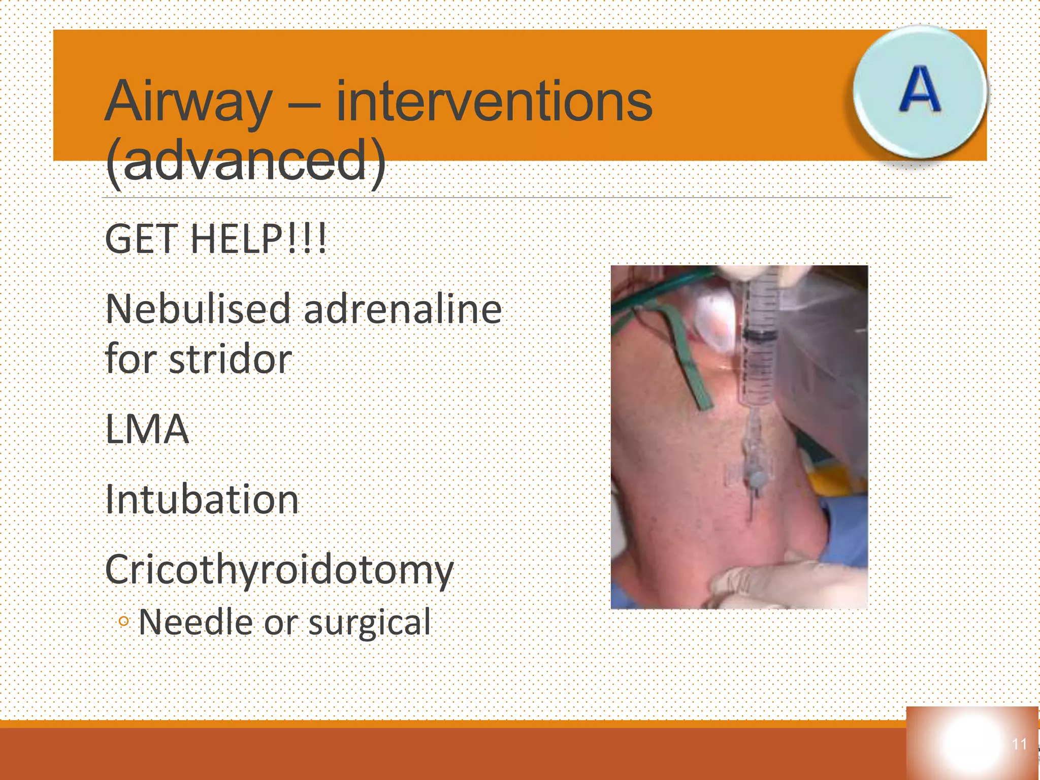 Abcde approach-to-the-critically-ill-patient | PPTX