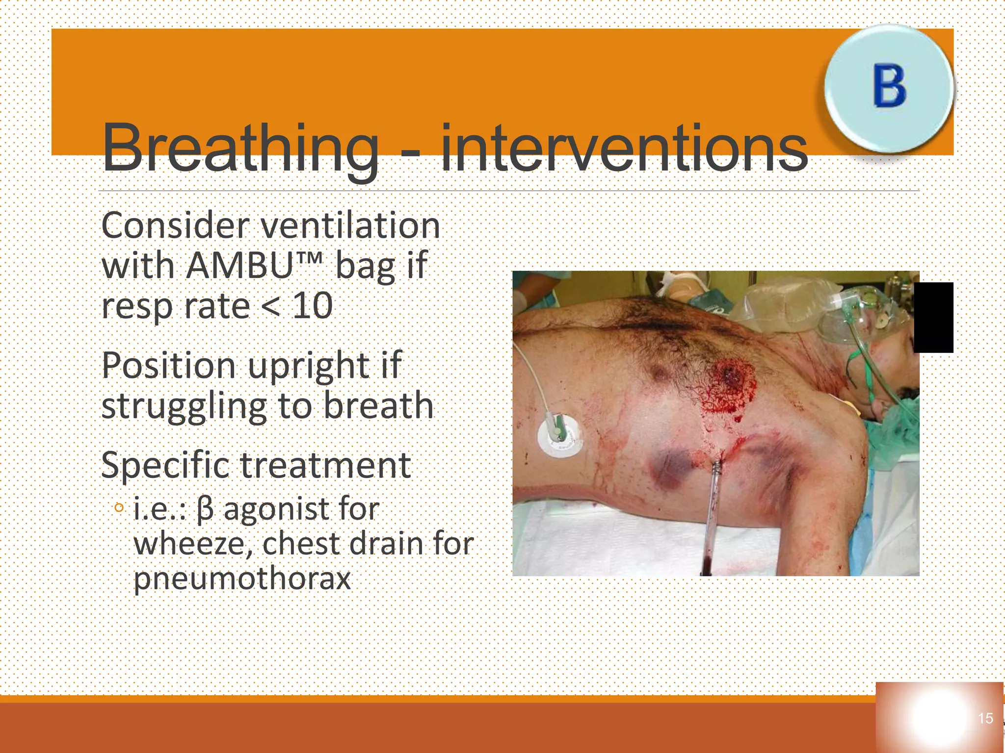 Abcde approach-to-the-critically-ill-patient | PPTX