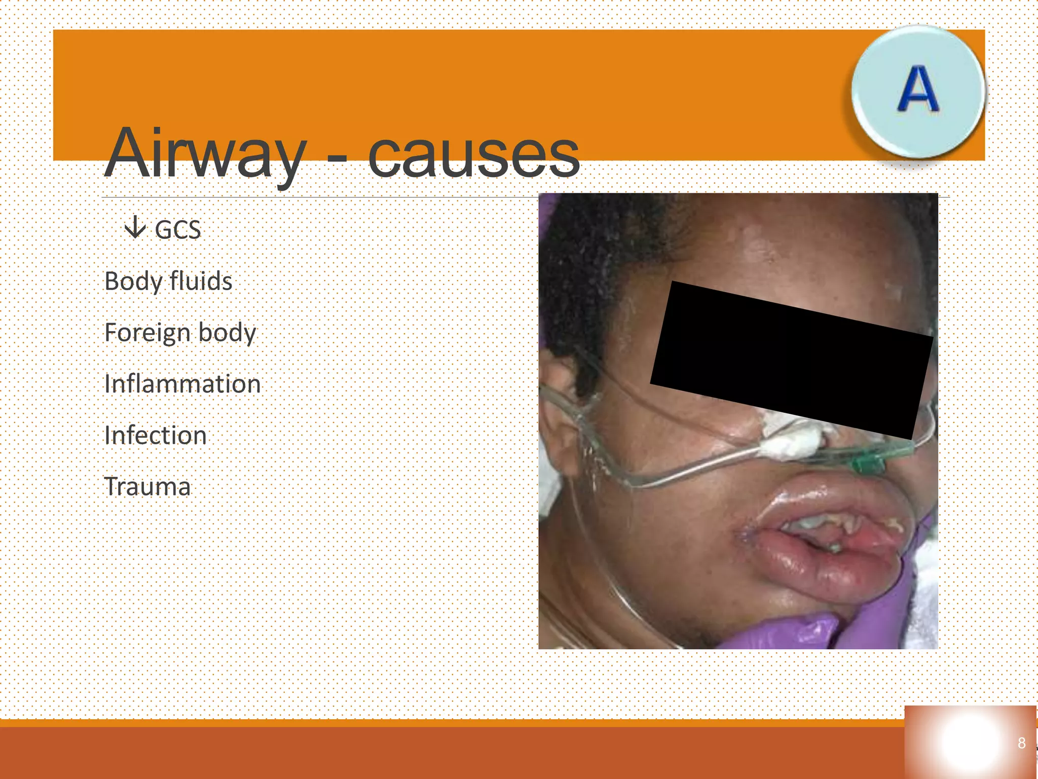 Abcde approach-to-the-critically-ill-patient | PPTX