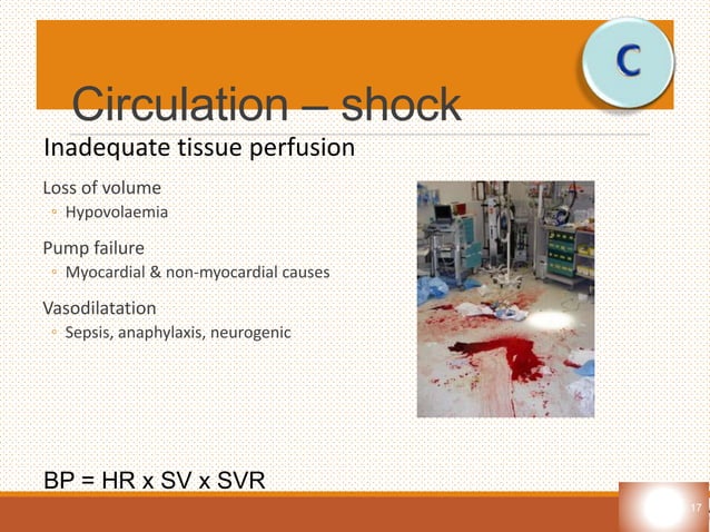 Abcde approach-to-the-critically-ill-patient | PPTX