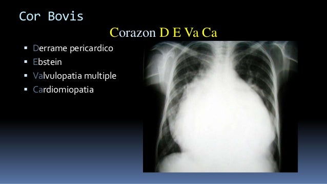 Abc de cardio 2016 2