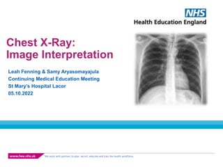 ABCDE CXR Final Version.pptx