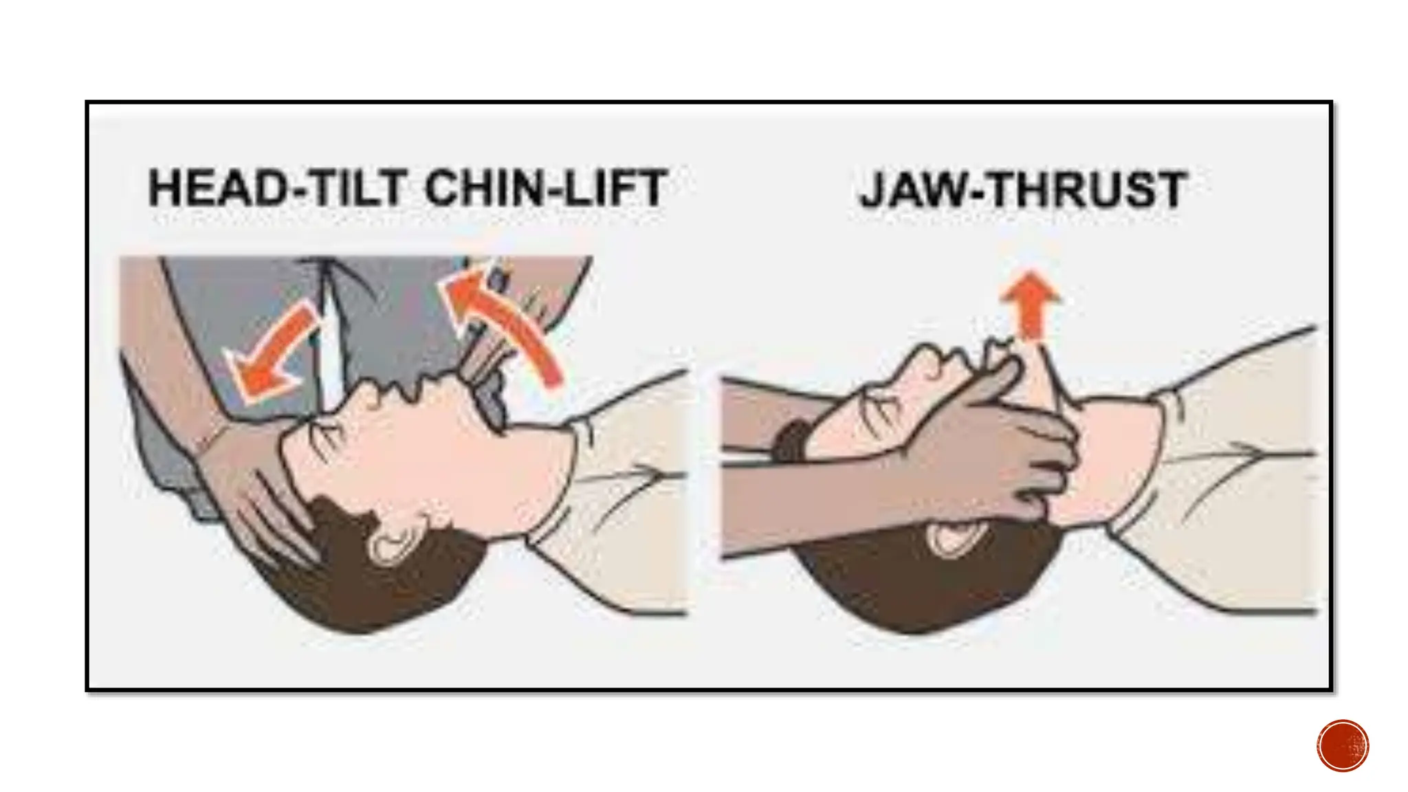 Airway Breathing Circulation EMERGENCY.pptx