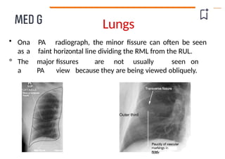 ABCDEFGH approach-- for chest X-Ray.pptx