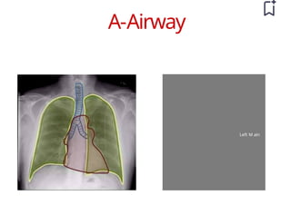 ABCDEFGH approach-- for chest X-Ray.pptx