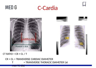 ABCDEFGH approach-- for chest X-Ray.pptx