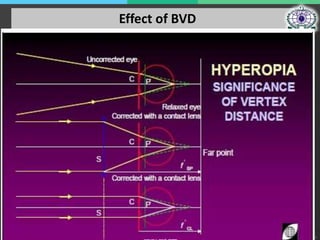optic of contact lens | PPTX