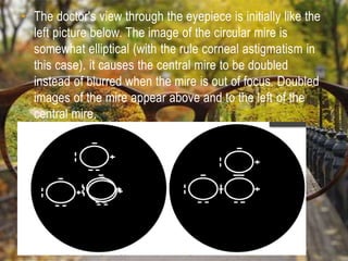 refractive technique | PPT