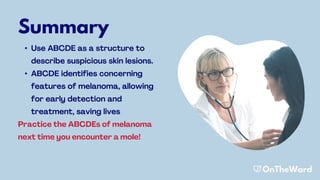 ABCDEs of Melanoma PowerPoint (OnTheWard.com) | PDF