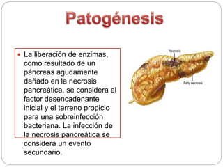 Abceso y Pseudoquiste Pancreático | PPTX