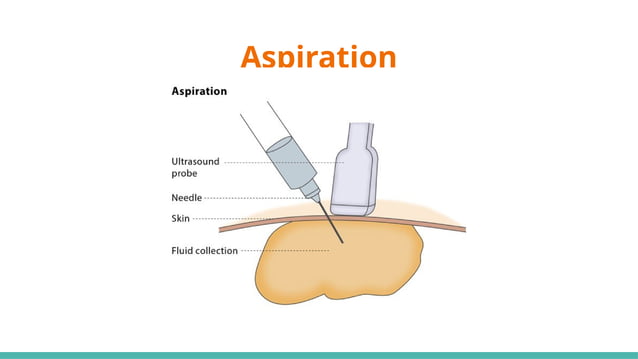Abcess Pptx Surgery Ppt Management Causes Pptx