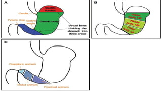 ABC In Upper Gastrointestinal Endoscopy.pptx