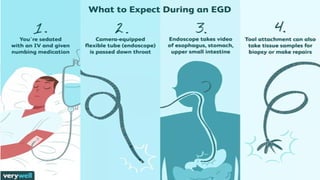 ABC In Upper Gastrointestinal Endoscopy.pptx