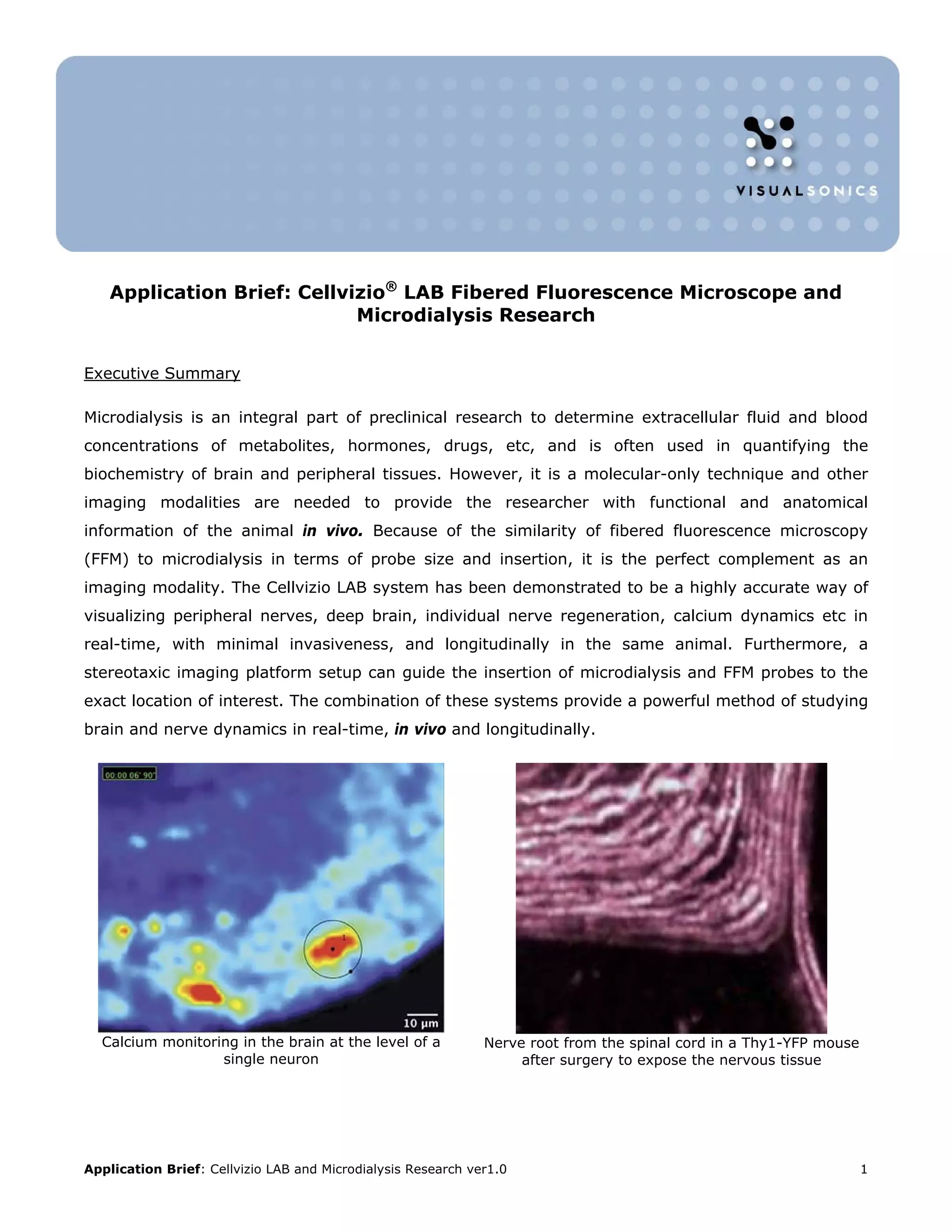 Cellvizio® LAB Fibered Fluorescence Microscope and Microdialysis ...