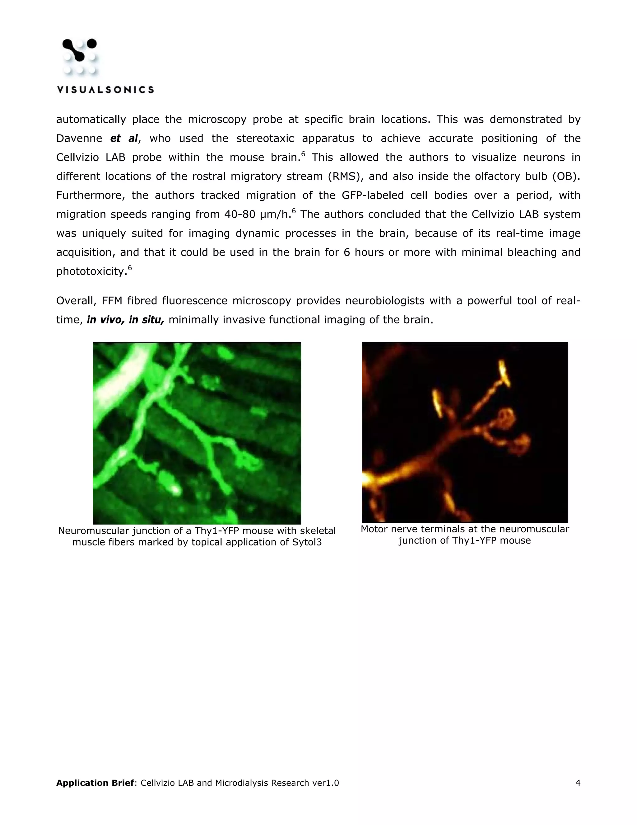 Cellvizio® LAB Fibered Fluorescence Microscope and Microdialysis ...