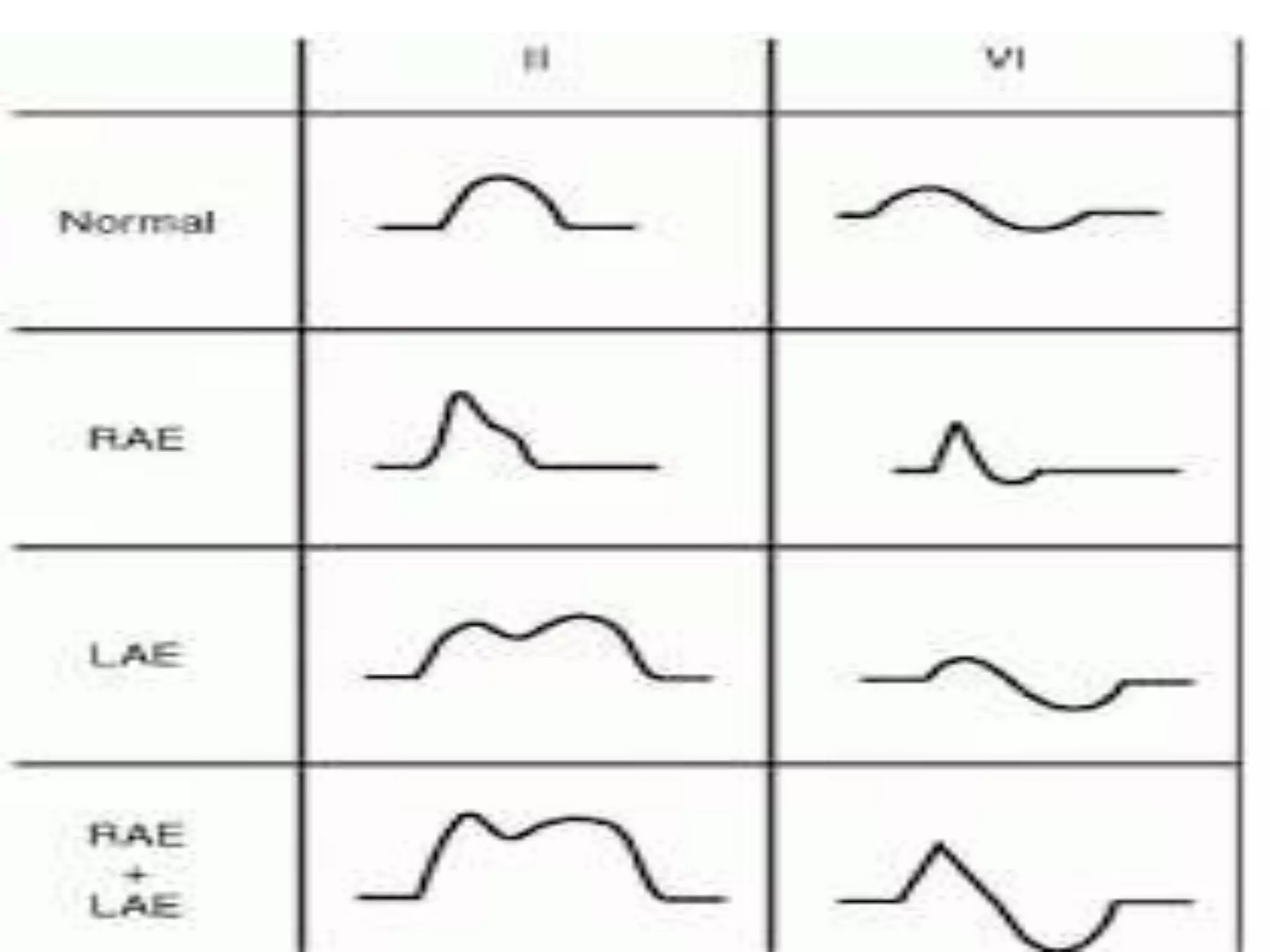 ABC of Electrocardiogram(ECG) | PPTX
