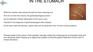 ABC OF ENDOSCOPY FOR THE SURGEON IN EASY STEPS | PPTX