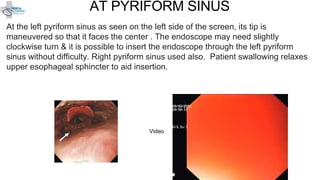 ABC OF ENDOSCOPY FOR THE SURGEON IN EASY STEPS | PPTX