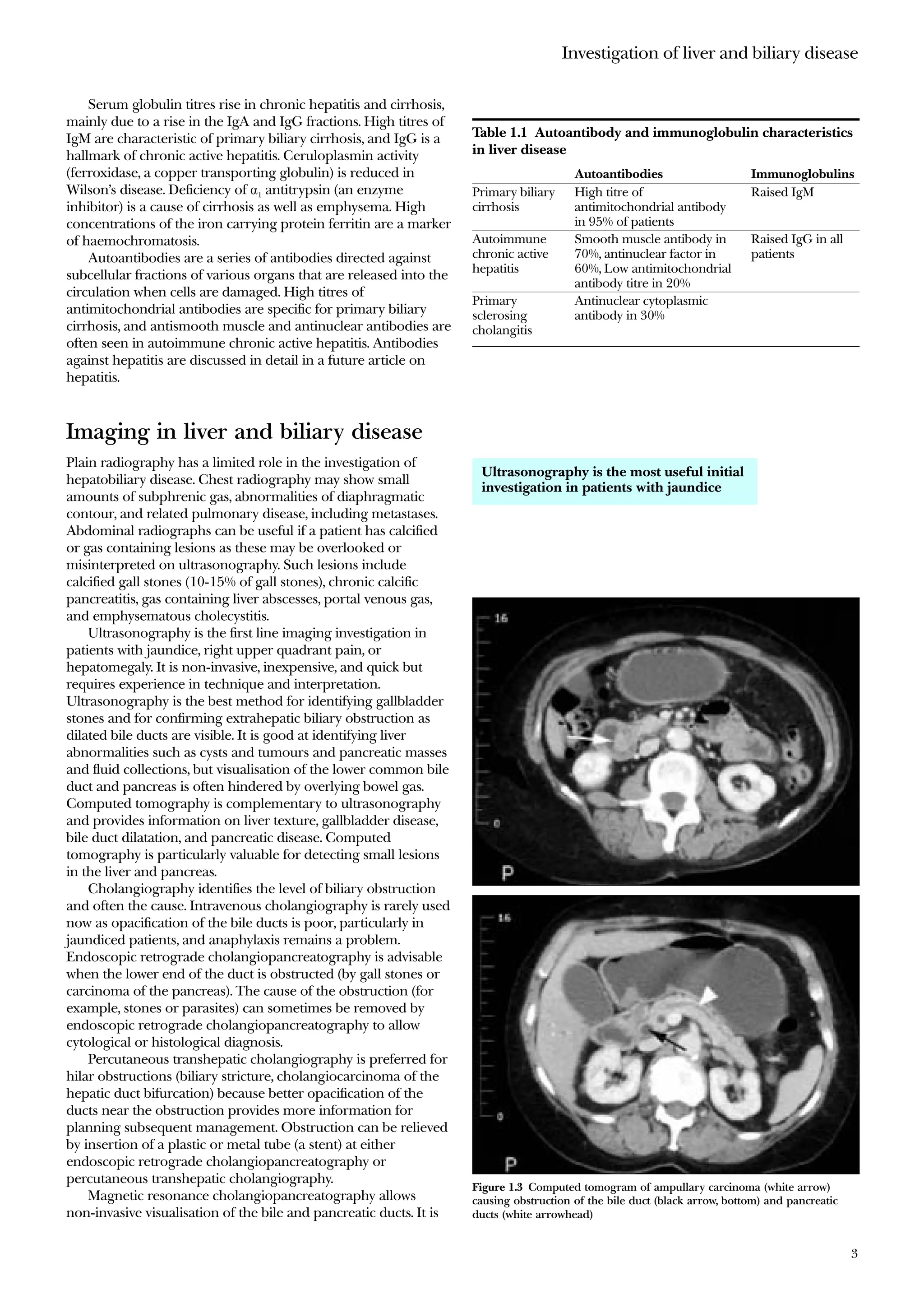 Abc of liver pancreas and gall bladder 2001 | PDF